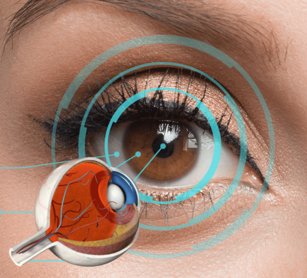 Types of Retinal Diseases and their Treatment- Iris Eye Care